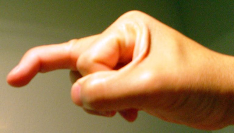 Mallet Finger | Joint Pain Info